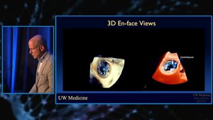 TEE Imaging for T-TEER: Patient Selection, Predictors of Success and ...