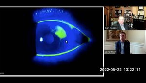 How to Diagnose, Manage, and Treat a Corneal Abrasion From a Cornea ...