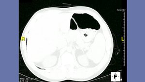 The Role of the Radiologist and the Healthcare Team in Diagnosis and ...