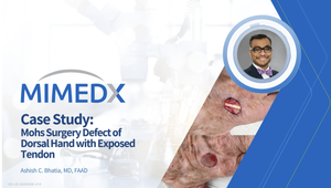 Case Study: Mohs Surgery Defect of Dorsal Hand with Exposed Tendon | Vumedi