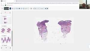 Cockerell Dermatopathology | Vumedi