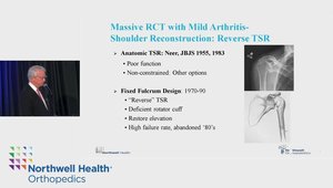 Massive RCT With Mild Arthritis - Shoulder Reconstruction | Vumedi