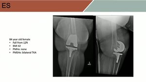 UT Health Houston Orthopaedic Trauma | VuMedi