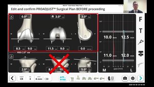 Inverse Kinematic Knee Alignment Ika Vumedi