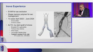 Aortic Aneurysm Management Results Through One-Year with a Conformable ...