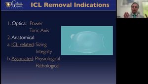 ASCRS 2025 Insights: 2 Minute, 3-Step Technique for Removal of ...