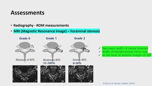 Preoperative Foraminal Stenosis on Cervical ROM and Neck Pain Following ...