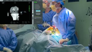 Robotic-Arm Assisted Functionally Aligned TKA Using a CPAK Restoration ...