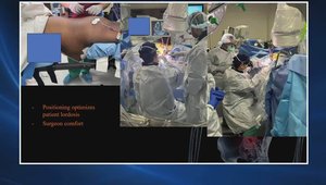 Prone Transpsoas Approach: Benefits and Limitations | Vumedi