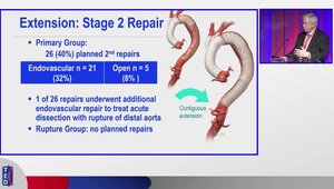 Update on Hybrid Repair of Aortic Arch and Thoracic Aortic Aneurysms ...