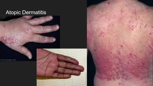 Dermatology Toolkit: A Guide for Common Skin Conditions 2025 | Vumedi