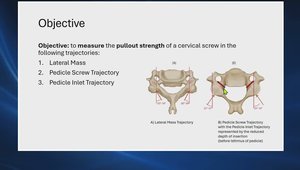 Cervical Pedicle Inlet Screws: A Novel Trajectory for Sub-Axial ...