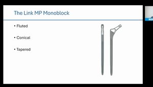 Why I Choose the MP Monoblock: A Fluted Tapered Hip That Delivers in ...