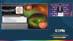 Debate: In the Setting of a Phakic Macula-On Retinal Detachment, With a ...