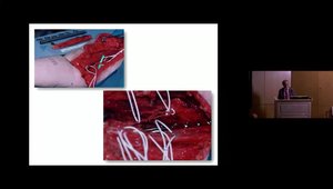 Codman Shoulder Society | Vumedi