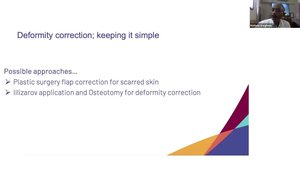 Deformity Correction: Keeping It Simple | Vumedi