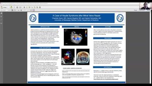 A Case of Heyde Syndrome After Mitral Valve Repair | Vumedi