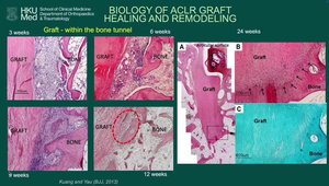 Biology of Healing and Remodelling of the Implanted Soft Tissue Tendon ...