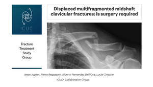 Displaced Multifragmented Midshaft Clavicular Fractures: Is Surgery ...