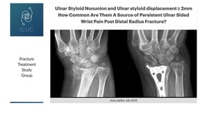 Ulnar Styloid Nonunion and Displacement ≥ 2 mm: How Common Are They as ...