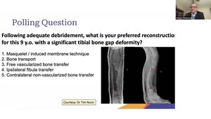 Panel Discussion: 9 y/o With Significant Tibial Bone Gap Deformity | Vumedi