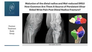 Malunion of the Distal Radius and Mal-reduced DRUJ: How Common Are They ...