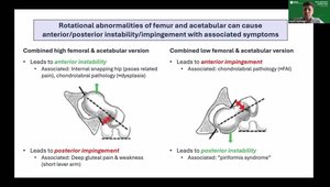 Kinetic Chain Relationships: The Synergy Between Lower Extremity Joints ...