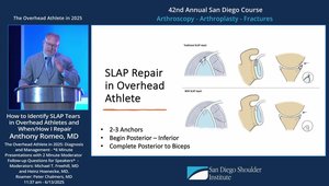 How to Identify SLAP Tears in Overhead Athletes and When/How I Repair ...