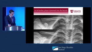 Sternoclavicular Joint Reconstruction Techniques | Vumedi