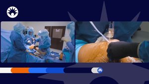 Surgiphor™ Antimicrobial Irrigation System Surgeon Testimonial and ...