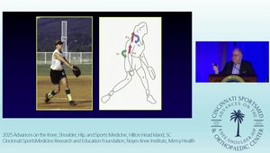Rehabilitation of the Thrower's Shoulder: What Have I Learned in 40 ...