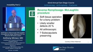 Technique: Arthroscopic McLaughlin Procedure & Other Solutions for the ...