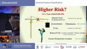 Acromial Fracture Classification | Vumedi