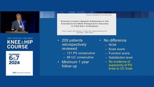 What Do We Know About All the Liner Options Without a Post in the ...