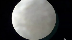 Sphenopalatine Artery Ligation: Endoscopic Technique for Epistaxis ...