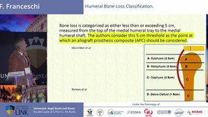 Humeral Bone Loss Classification | Vumedi