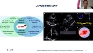 ESC 2025 Insights: Validation of Red Flags in Cardiac Amyloidosis ...