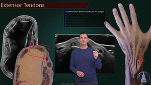 Extensor Tendons of the Wrist: Systematic Ultrasound Approach by ...