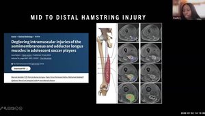 RSNA 2025 Insights: Update on Imaging of the Hamstring Tendons and ...