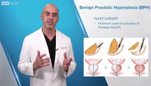 Holmium Laser Enucleation of the Prostate for BPH at UCLA Health | Vumedi