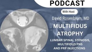 Multifidus Atrophy: Multifidus Stimulation, Peripheral Nerve ...
