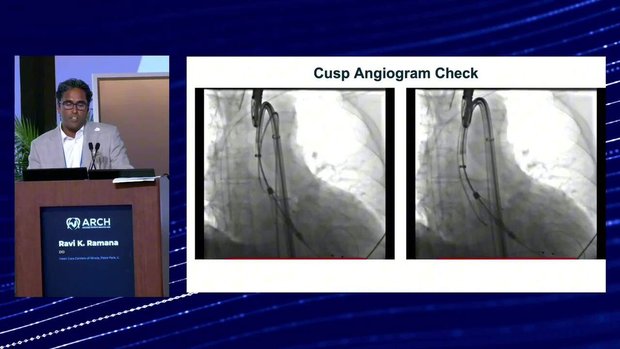 ARCH Advanced Revascularization Symposium | Vumedi