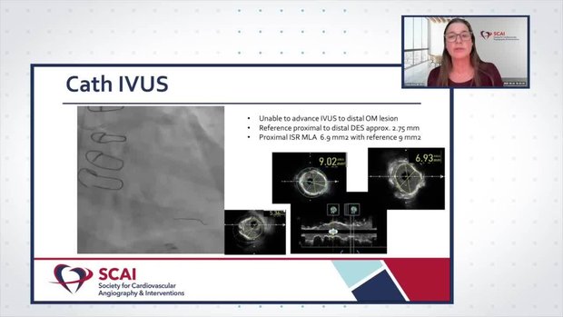 Society for Cardiovascular Angiography & Interventions (SCAI) | Vumedi