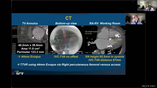 Society for Cardiovascular Angiography & Interventions (SCAI) | Vumedi