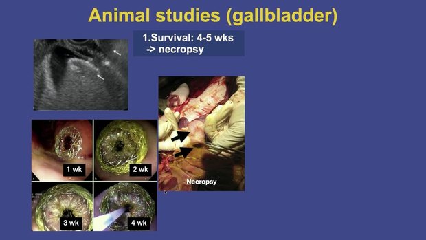 The Journey of LAMS Development: From Concept to Clinical Practice | Vumedi