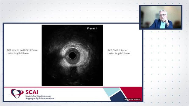 Society for Cardiovascular Angiography & Interventions (SCAI) | Vumedi